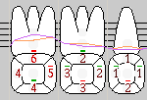 PAR-Befund im Zahnschema